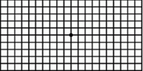 double vision wavy lines